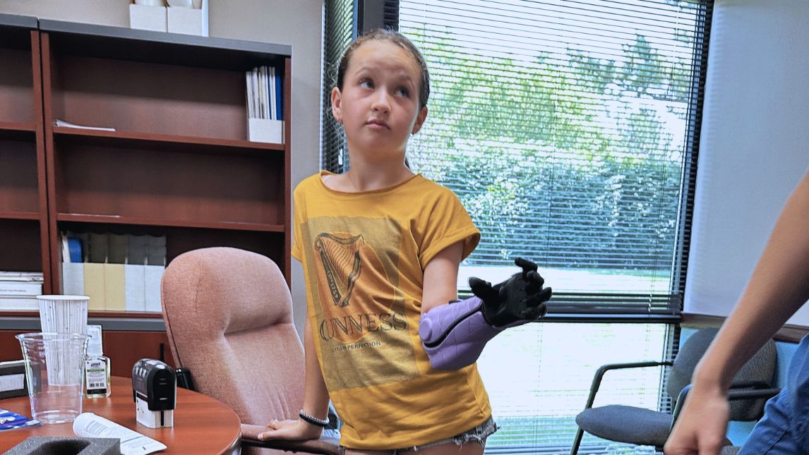 Quinn discovers her prosthetic arm